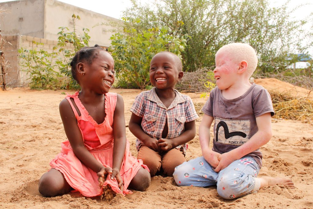UN International Albinism Awareness Day: Shedding Light on Challenges ...